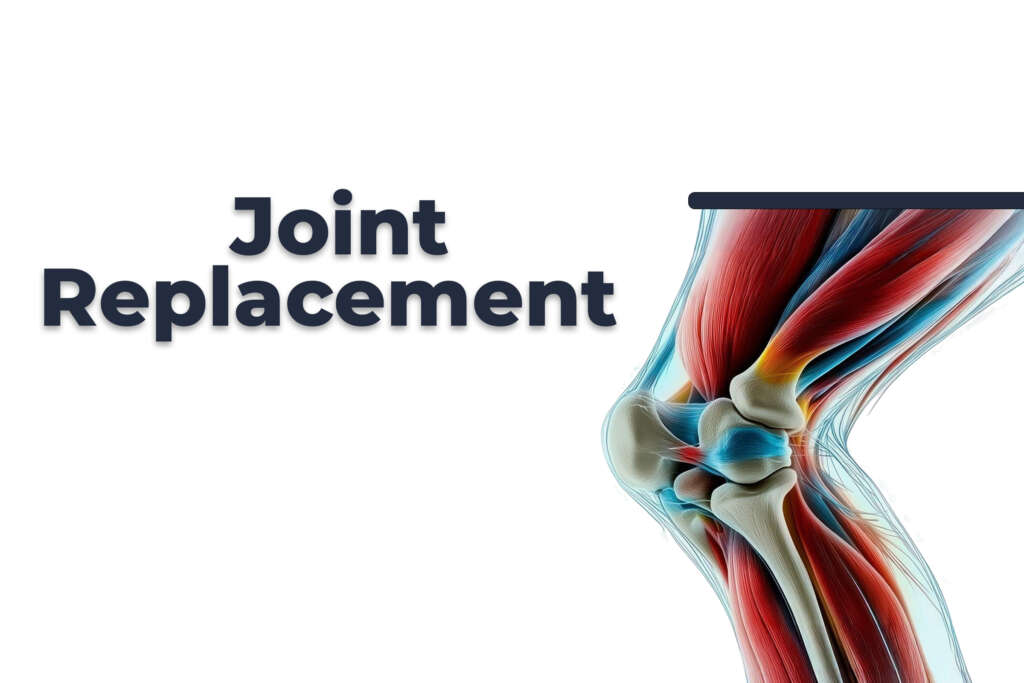 Joint Replacement - Dr. Param Ortho